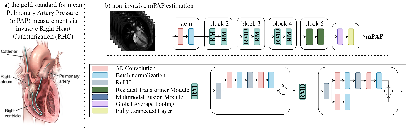 Deep Learning for Noninvasive Pulmonary Hypertension Diagnosis - Centre ...
