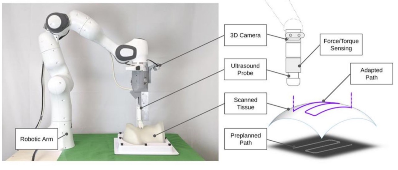 Robotic Assisted UltraSound (RAUS) - Centre for Computational Personalized Medicine