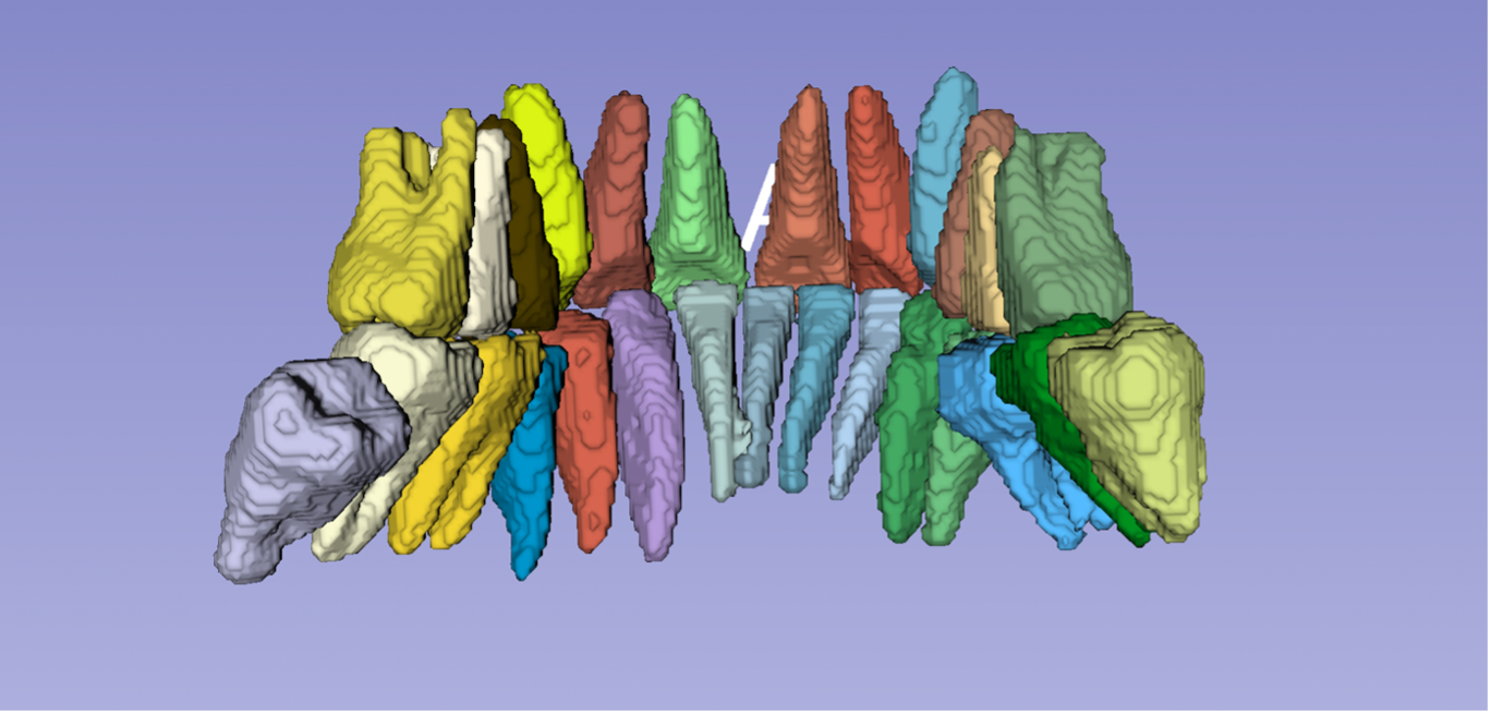 Orthodontic treatment planning - Centre for Computational Personalized Medicine